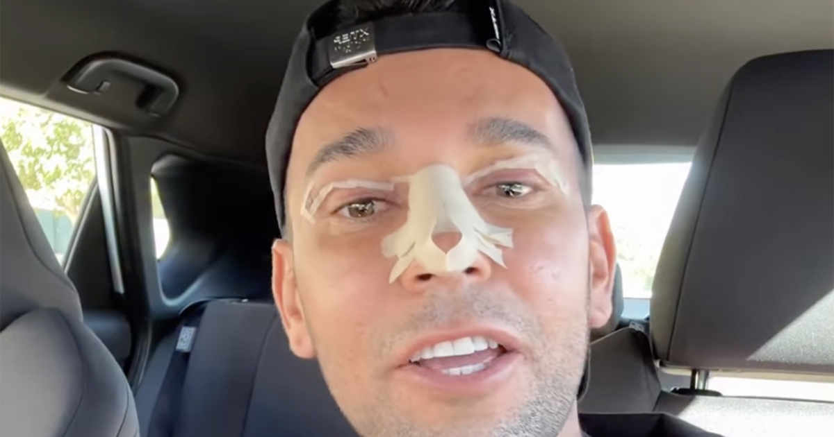 Omar Sánchez muestra su nuevo rostro tras someterse a dos operaciones ...